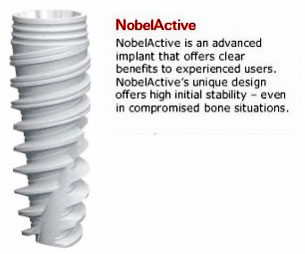 Nobel Biocare Dental Implants in Delhi, India | Dr. Kathuria