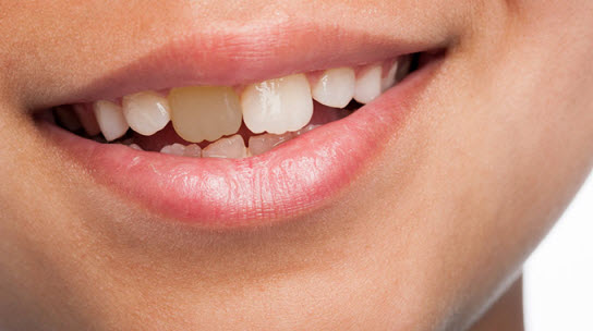 12 Teeth Problems with Pictures. Number 10 is Very Common