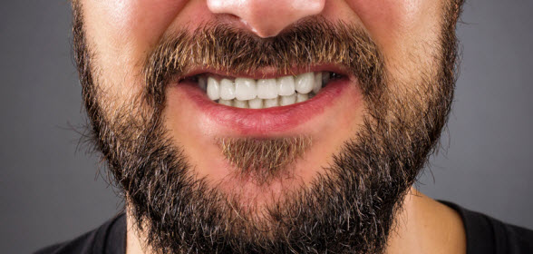 12 Teeth Problems with Pictures. Number 10 is Very Common